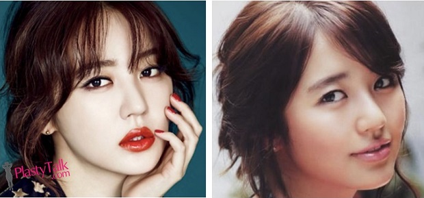Yoon Eun Hye Plastic Surgery With Before And After Photos
